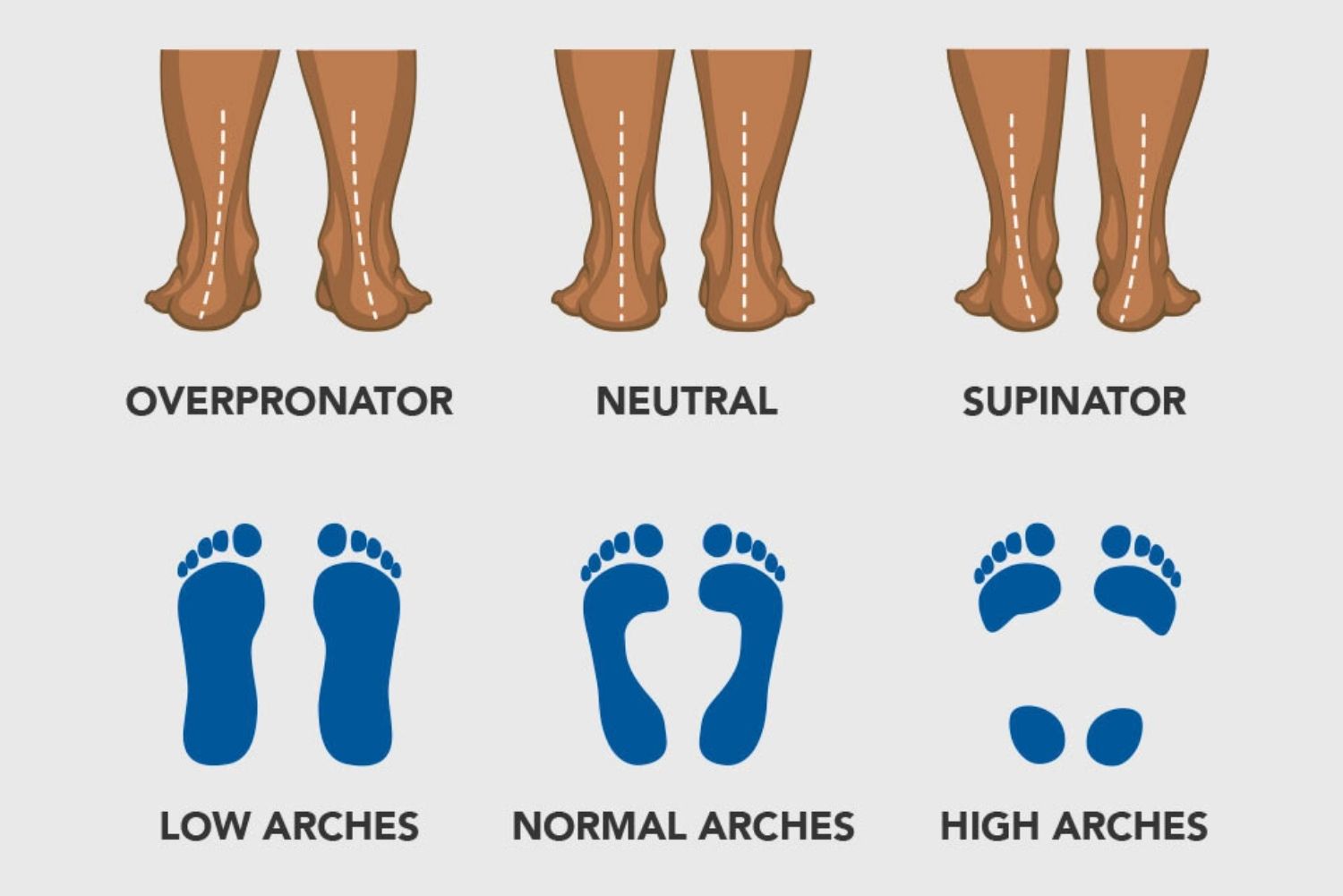 Run Faster with Gait Analysis - Stay Tuned Sports Medicine